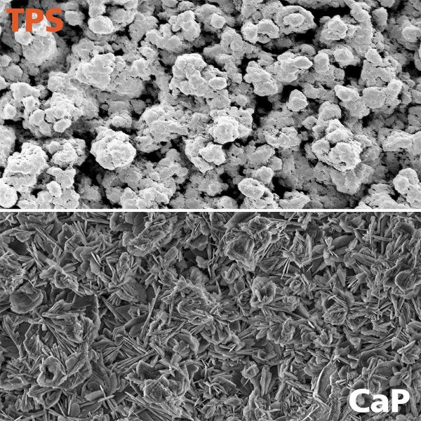 OPTIMYS – Artrotek